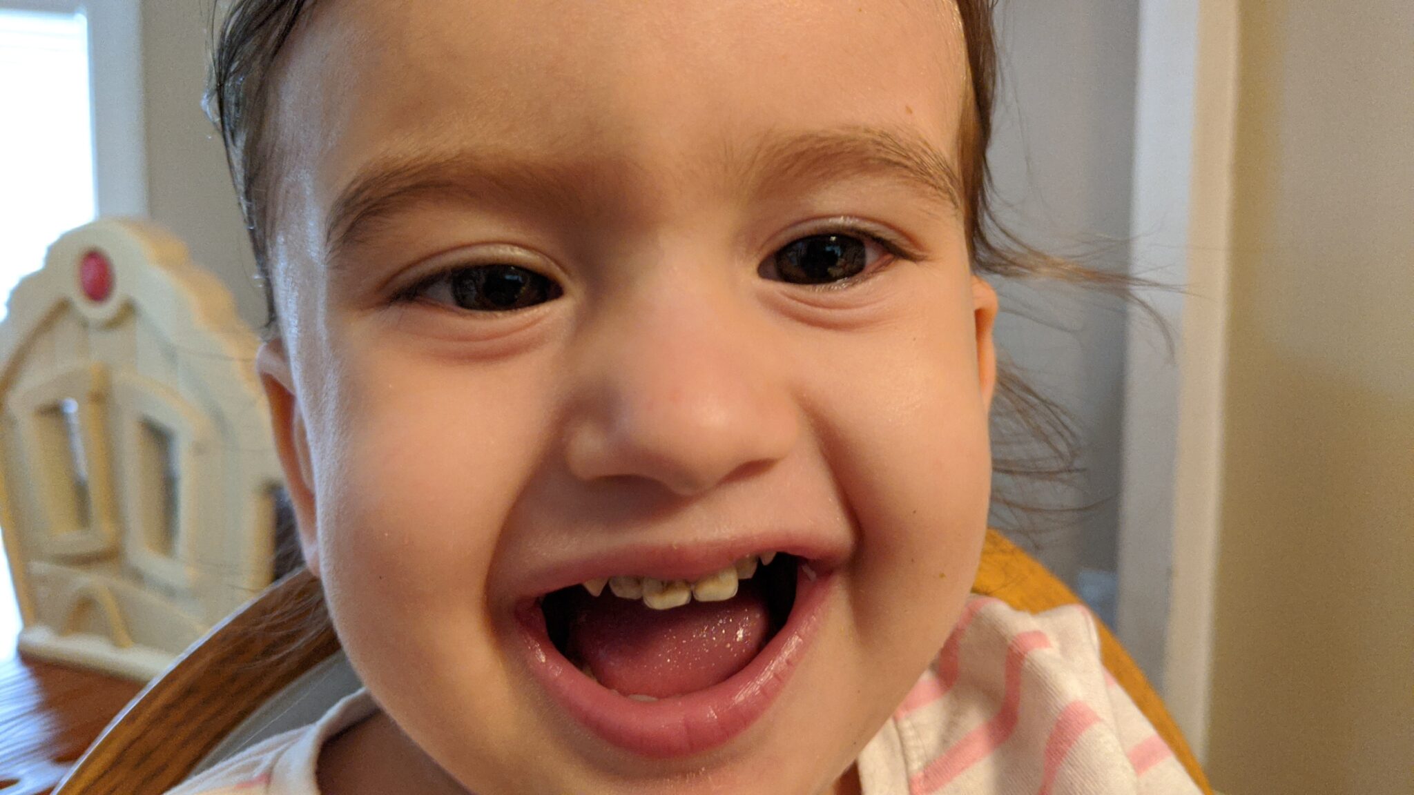 Natural Treatments for ECC (Early Childhood Caries) • MAMA RISSA