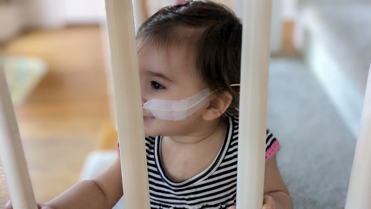 When You Have to Place a Baby Feeding Tube, Part II: How to Insert a ...